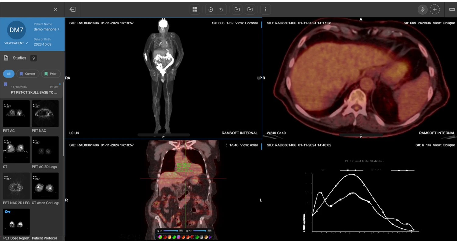 OmegaAI - Cloud-native, Zero-Footprint RIS/PACS/VNA